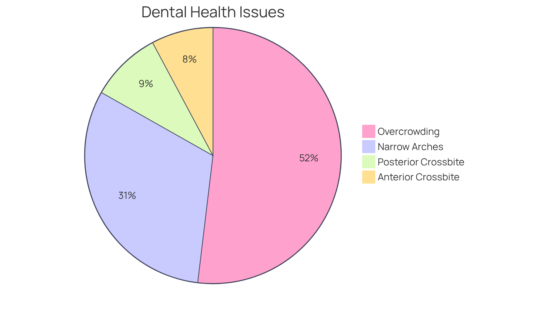 Each segment of the pie chart shows how common each dental issue is among children. The larger the segment, the more prevalent the issue. Overcrowding is the most common, followed by crossbites and narrow arches.